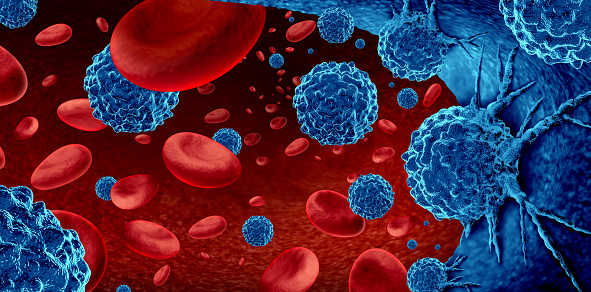 Fucoidan Effect On Leukemia U937 Cancer And Fucoidan Fucoidan Effect On Leukemia U937 Cancer And Fucoidan